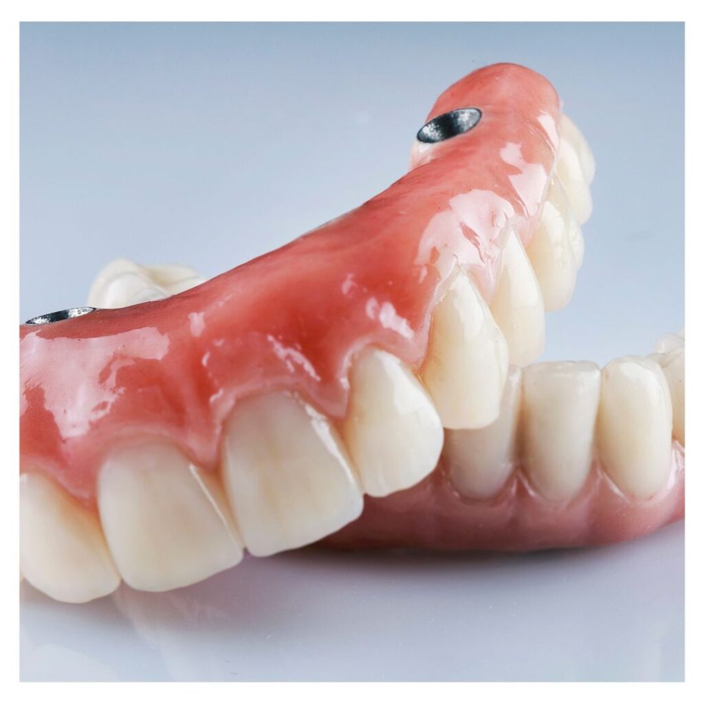 Prótese Dentária - Comdente Odontologia